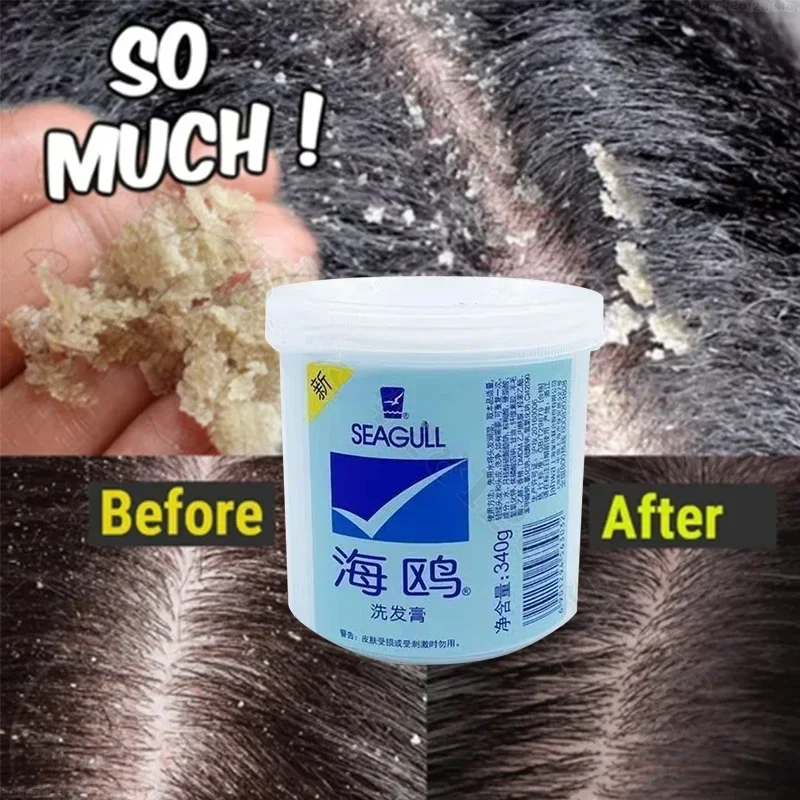 Chinese-nostalgic-gull-walnut-moisturizing-gull-dandruff-shampoo ...