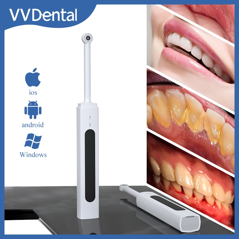 Dental-Intraoral-Camera-Wireless-WIFI-Intra-Oral-Camera-High-Definition ...