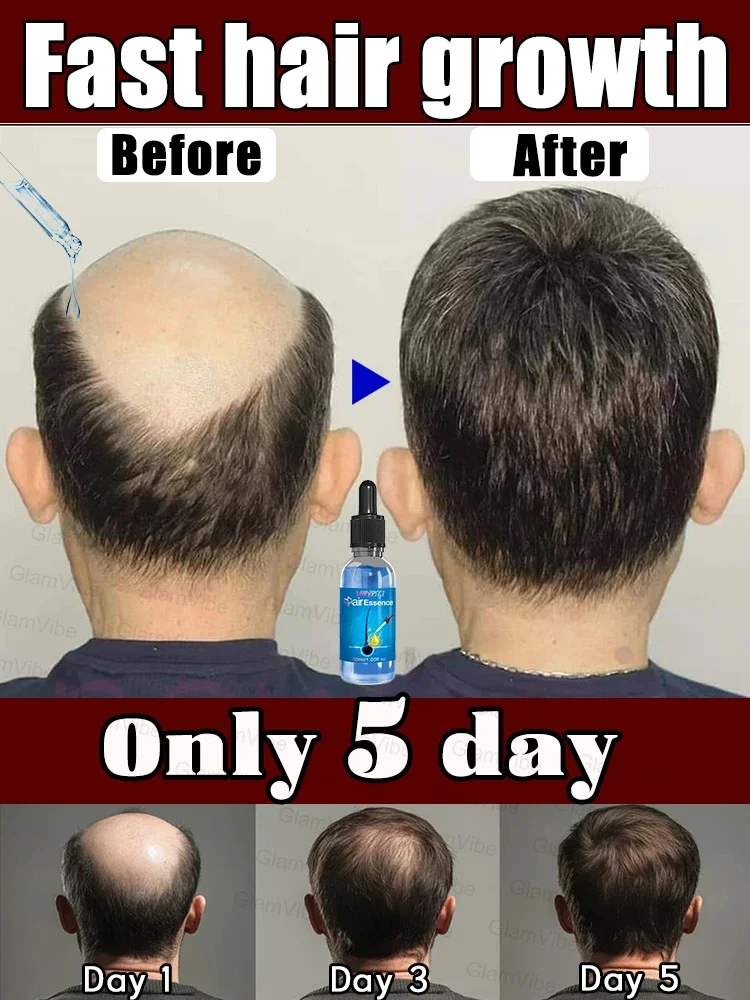 WPRBREGT blue bottle.hair growth essential 0iI. Say goodbye to baIdness ...