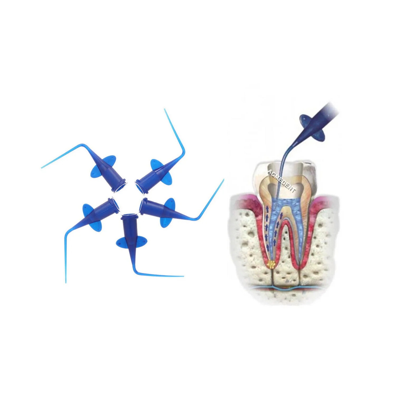 1000-pieces-Dental-Disposable-Plastic-Syringe-Tip-Endo-Irrigation-Root ...