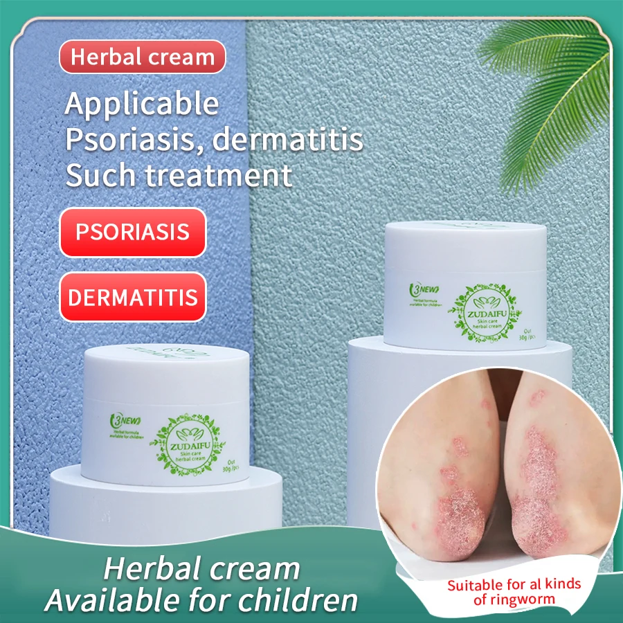 3ird Generation Of ZUDAIFU With Retail Box Skin Psoriasis Cream ...