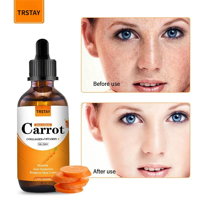 New Carrot Essence Essential Oils Dark Spot Corrector Face Whitening ...