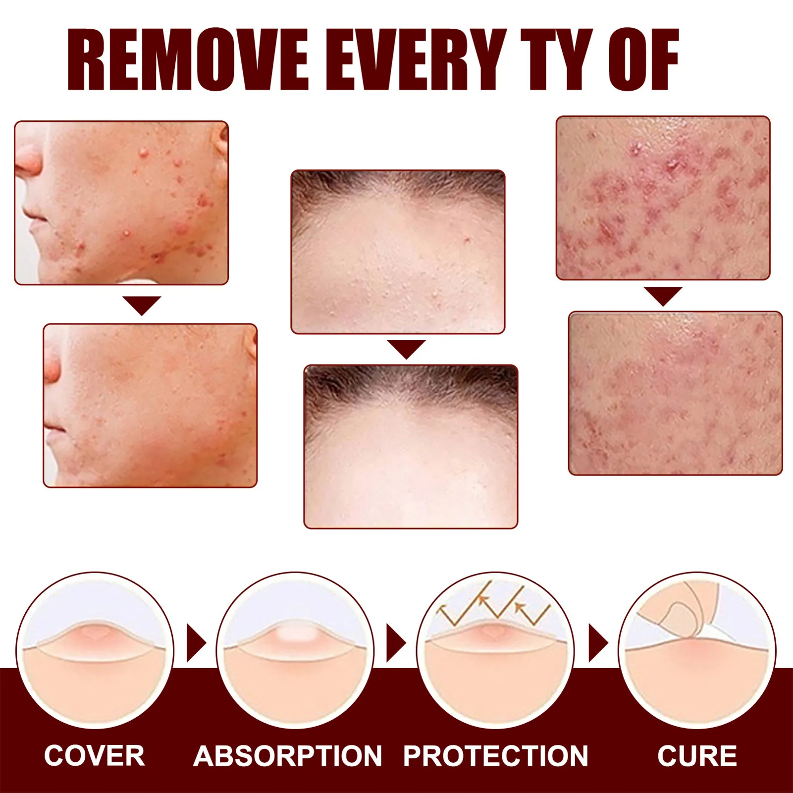 Mole Removal Patch Waterproof Wart And Mole Remover Kit Translucent ...