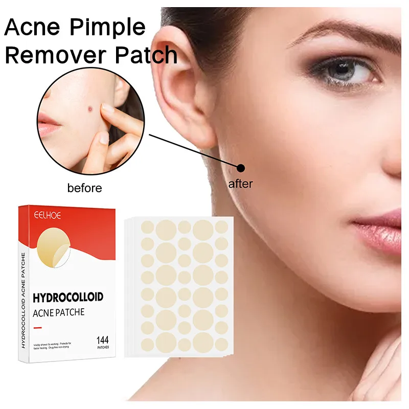 Invisible-Acne-Patches-144pcs-box-Acne-Skin-Repair-Patch-Waterproof ...