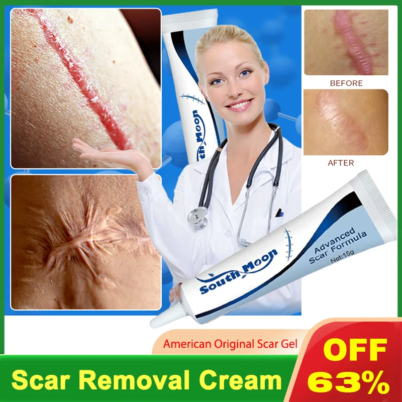Remover Queimar Cicatrizes Creme Gel Remover Estrias Acne Spots Tratamento Queimadura Cirurgia ...