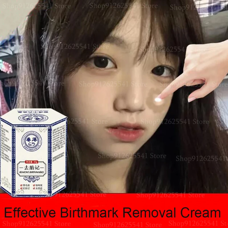 Birthmark-Removal-Cream-Whitening-Freckles-Cream-Facial-Spots-Skin-Dark ...