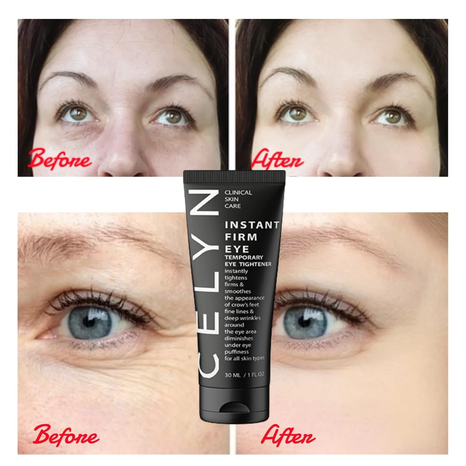Instant-Firm-Eye-Tightener-Instant-Eye-Bag-Tightener-Eye-Tightener-To ...