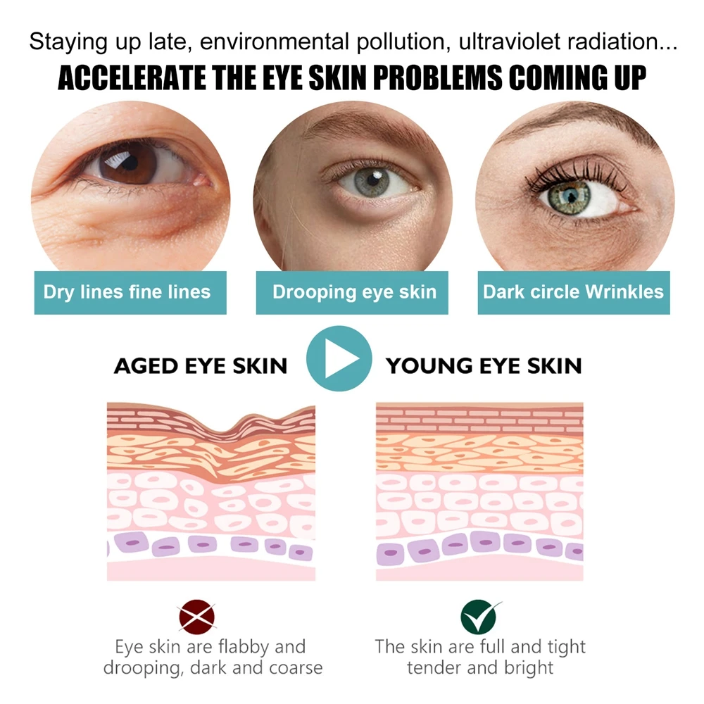 Young Eye Wrinkles