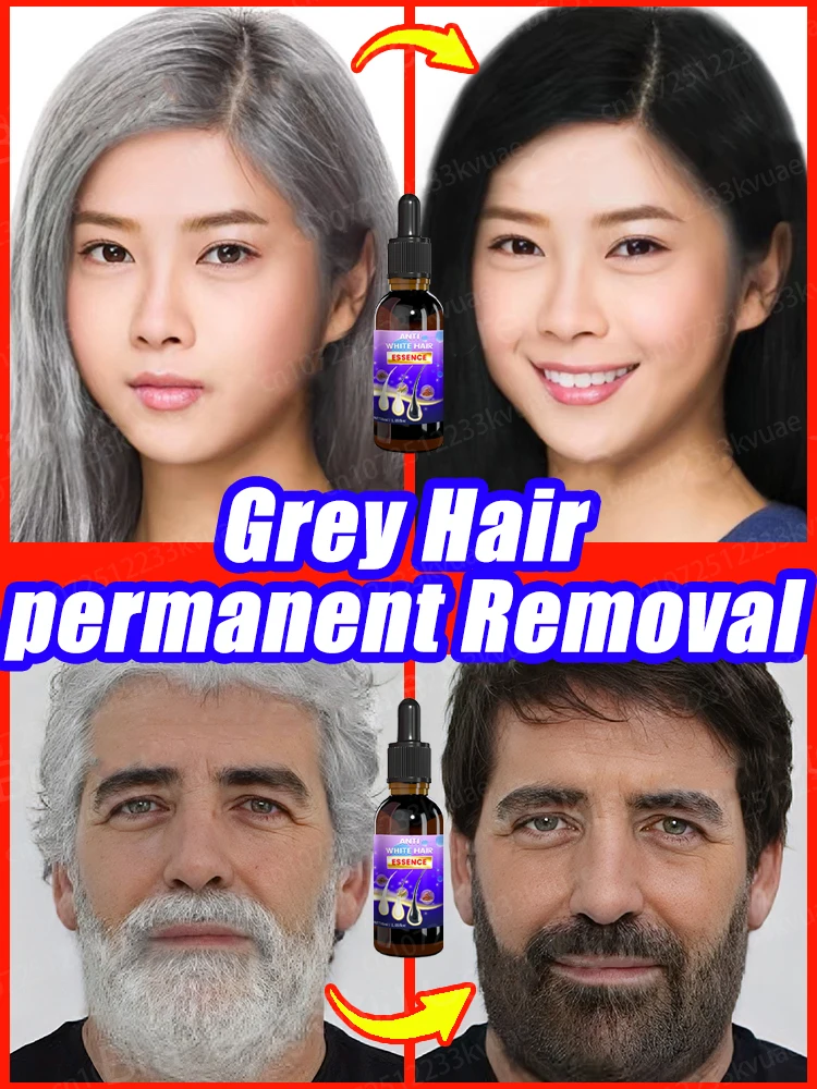 Gray-Hair-Treatment-Serum-White-to-Black-Natural-Color-Repair ...