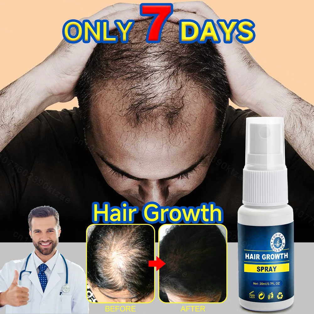 Prevent-Hair-Loss-Repair-Hair-Strong-Hair-Growth-Spray-Nourishes-Hair ...