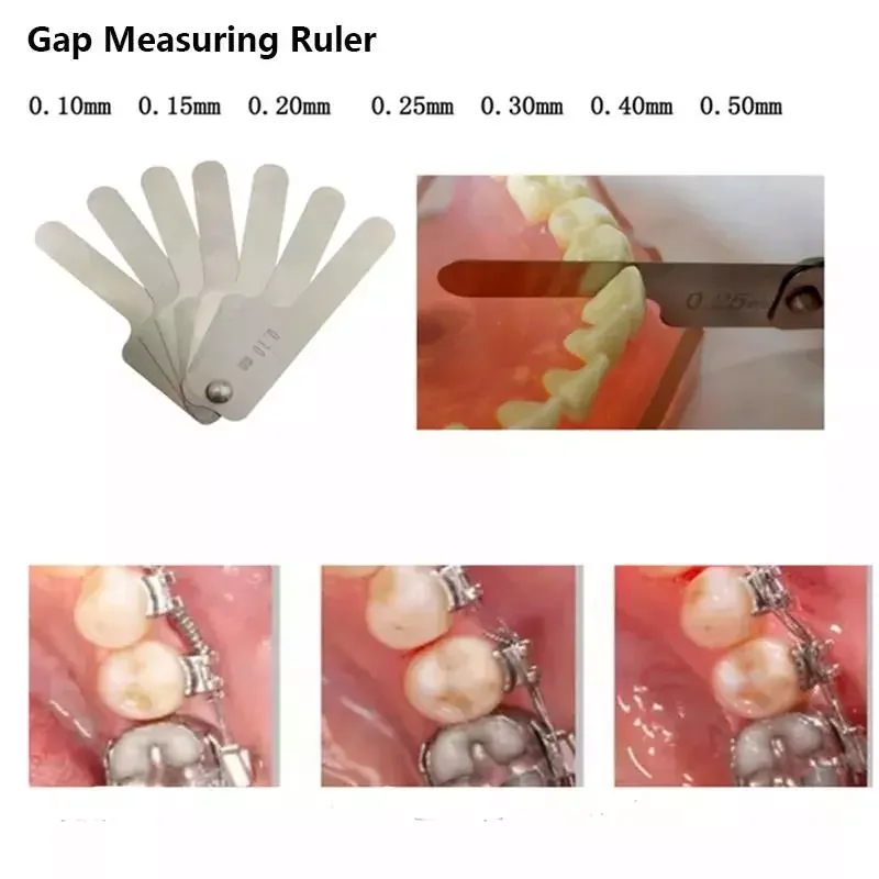 Oral-Interproximal-Reduction-Gauge-Ruler-Tooth-Gap-Measure-Reciprocating-IPR-System-Stainless ...