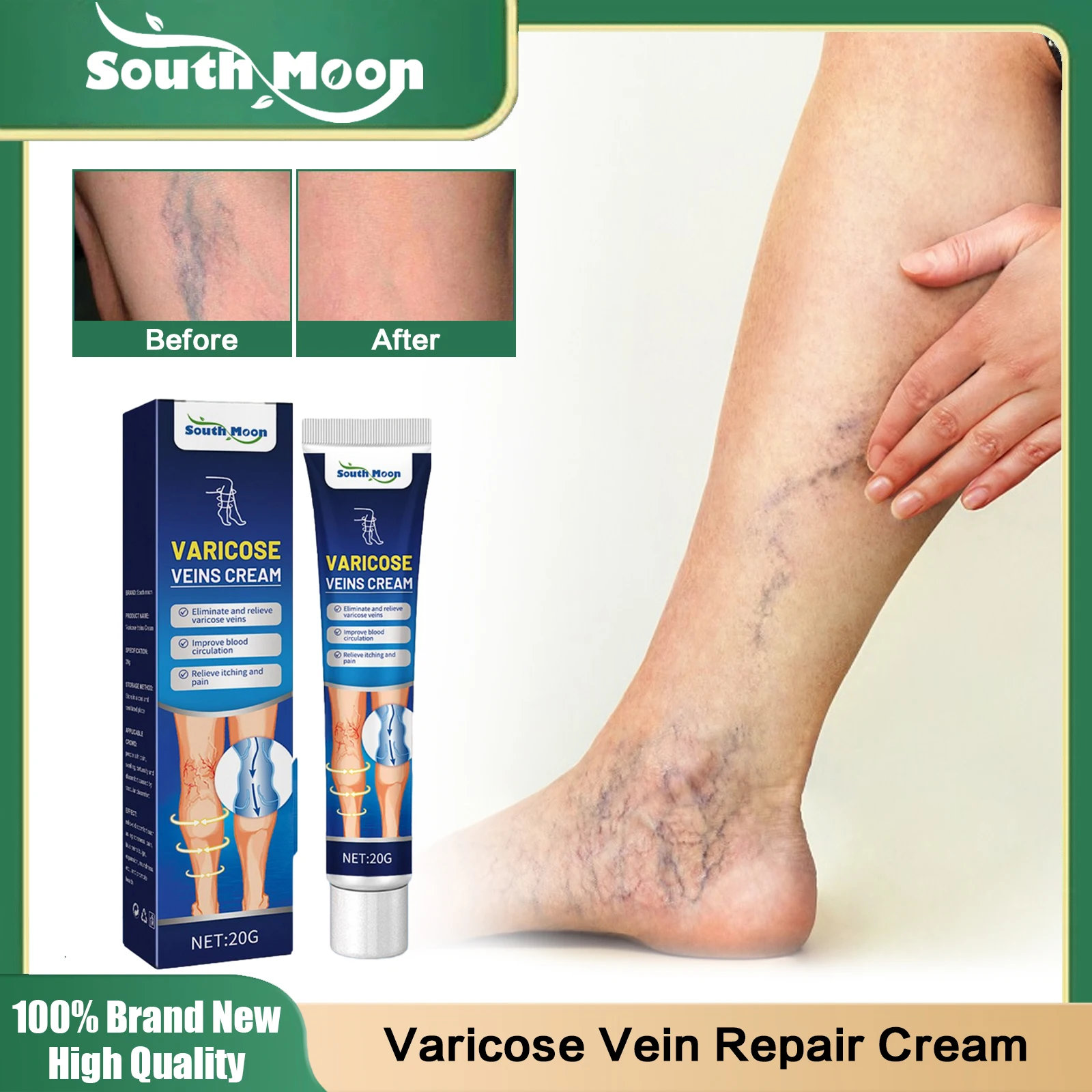 Creme-Reparador-de-Varizes-Aliviar-Pernas-Dor-Incha-o-Eliminar ...