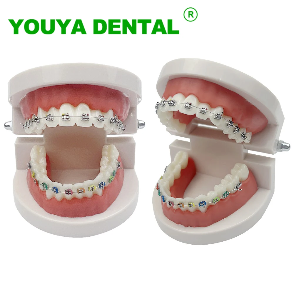 Orthodontic-Model-With-Self-Ligating-Metal-Bracket-Teeth-Teaching-Study ...