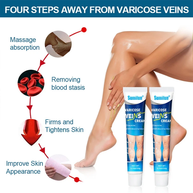Varicose Veins Treatment Ointment Cream Relief Veins Pain Vasculitis ...