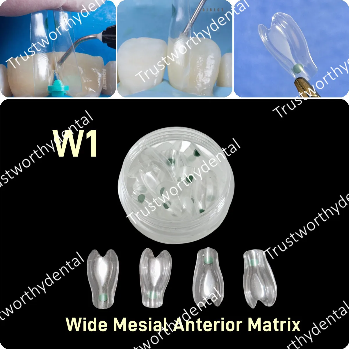 Dental-Transparent-Matrix-Clear-Anterior-Mesial-Front-Teeth-Matrice ...