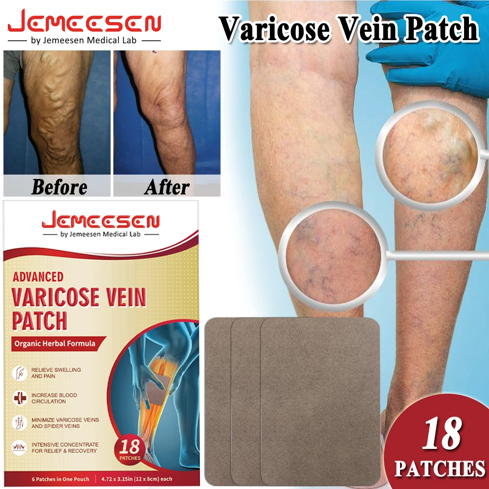 Jemeesen-Advanced-Varicose-Vein-Patch-Reduce-Varicose-Veins-And ...