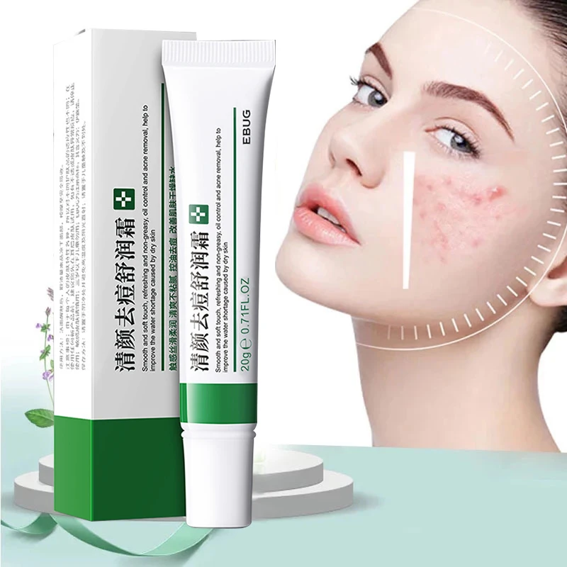 Crema de eliminación de acné a base de hierbas, tratamiento eficaz ...