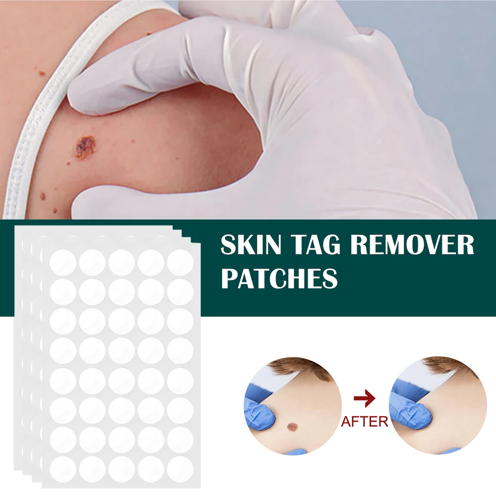 120pcs-Skin-Tag-Remover-Patch-Wart-Treatment-Stickers-Quick-Absorb ...