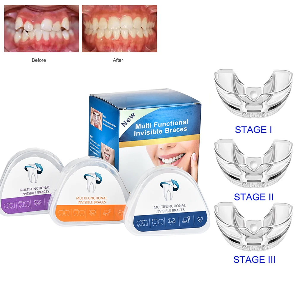 Orthodontic-Braces-Dental-Braces-Smile-Teeth-Alignment-Trainer ...