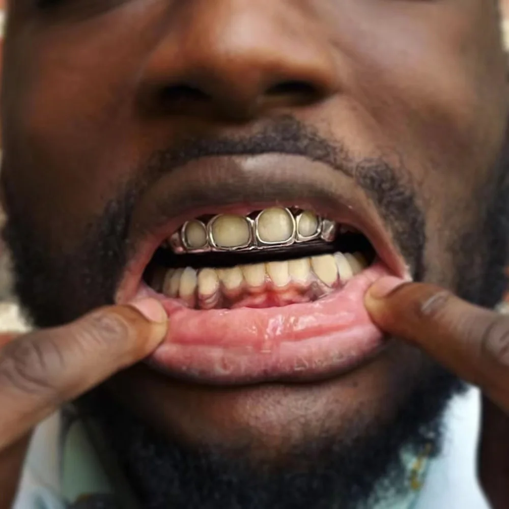 RACHELZ-Hip-Hop-Gold-Plated-Teeth-Grillz-Fashion-Top-Bottom-Hollow ...
