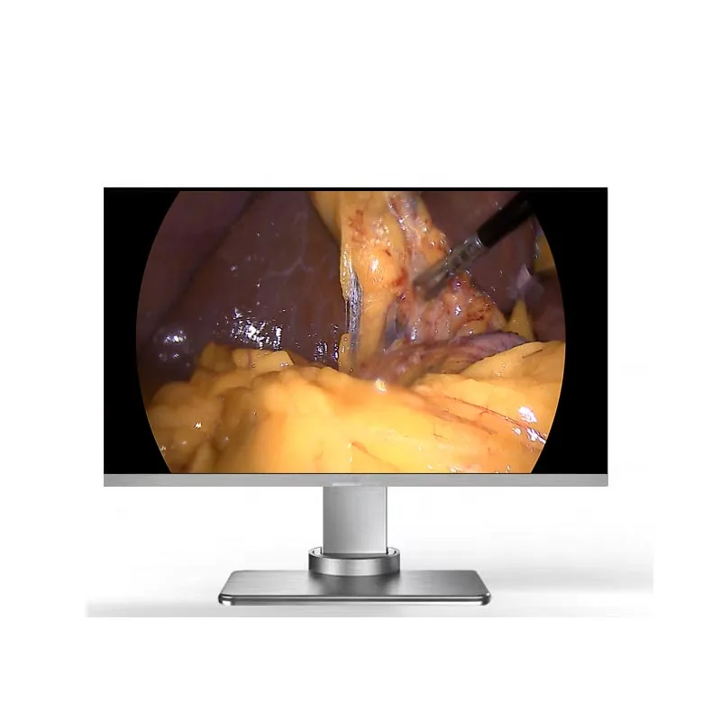 4k-27inch-medical-grade-endoscope-monitor-display.jpg