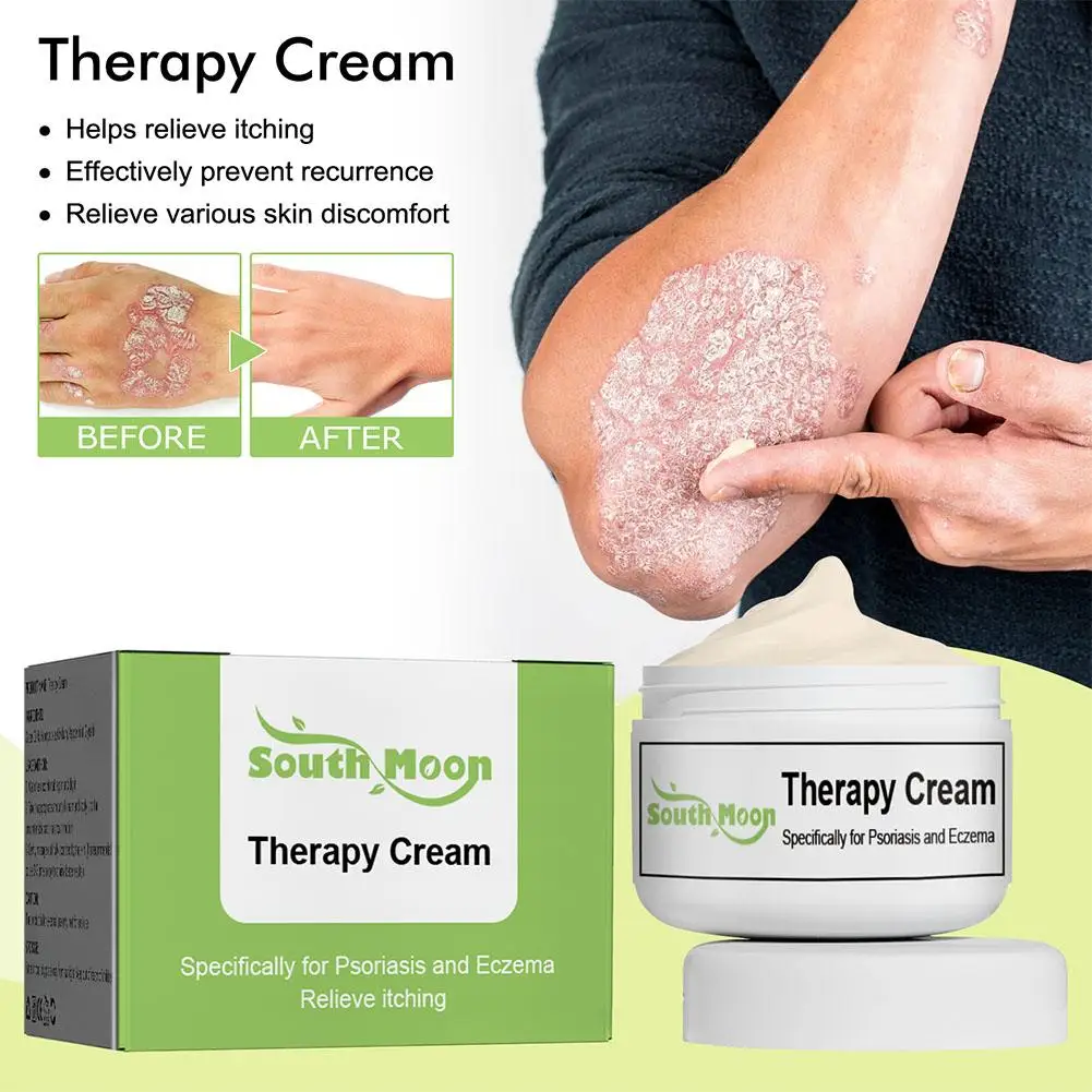 20g-Crème anti psoriasis à base de plantes, 20g, hydratante, peau ...