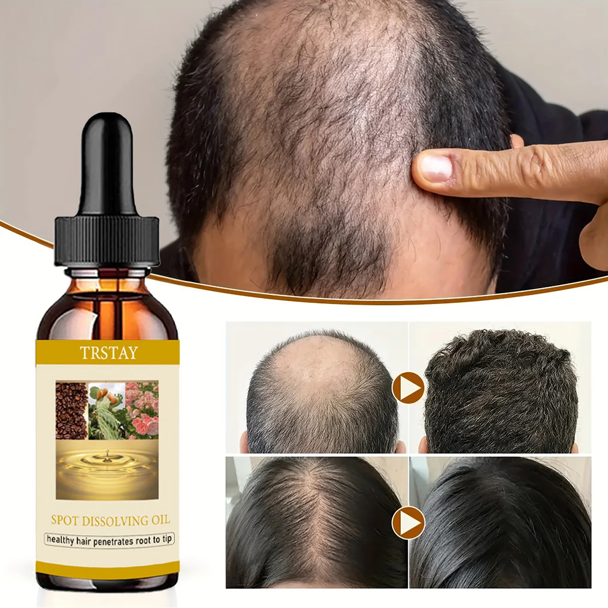 Ginger-Essence-Hair-Growth-Products-Fast-Regrowth-Oil-Serum-Prevent ...