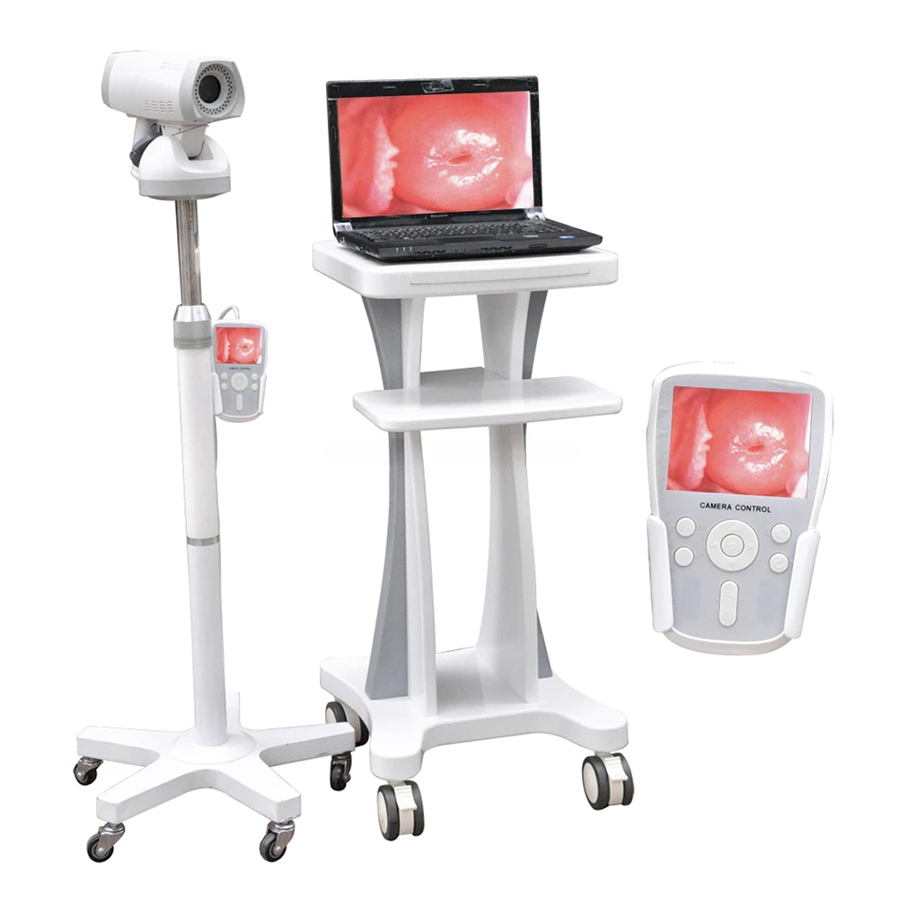 LH9800A-Mobile-Examination-Obstetrics-Gynecology-Video-Gynecological ...