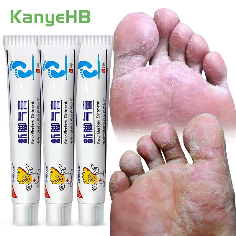 3pcs-Fungus-Treatment-Foot-Ointment-Anti-itch-Tinea-Pedis-Cream-Herbal ...