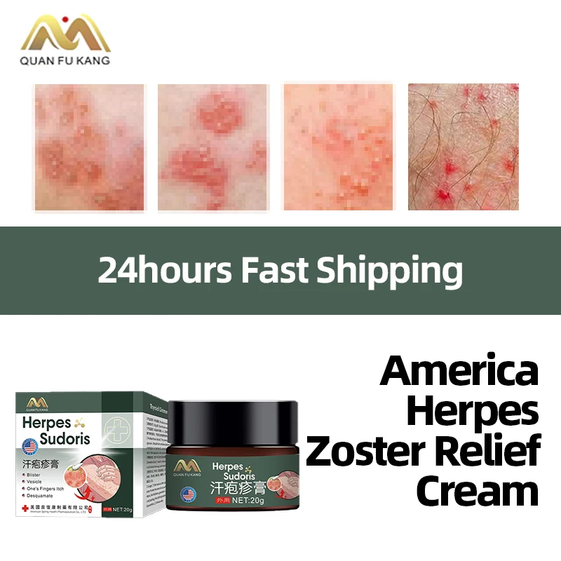 Herpes-Zoster-Treatment-Cream-American-Formula-Herpes-Simplex-Cure ...