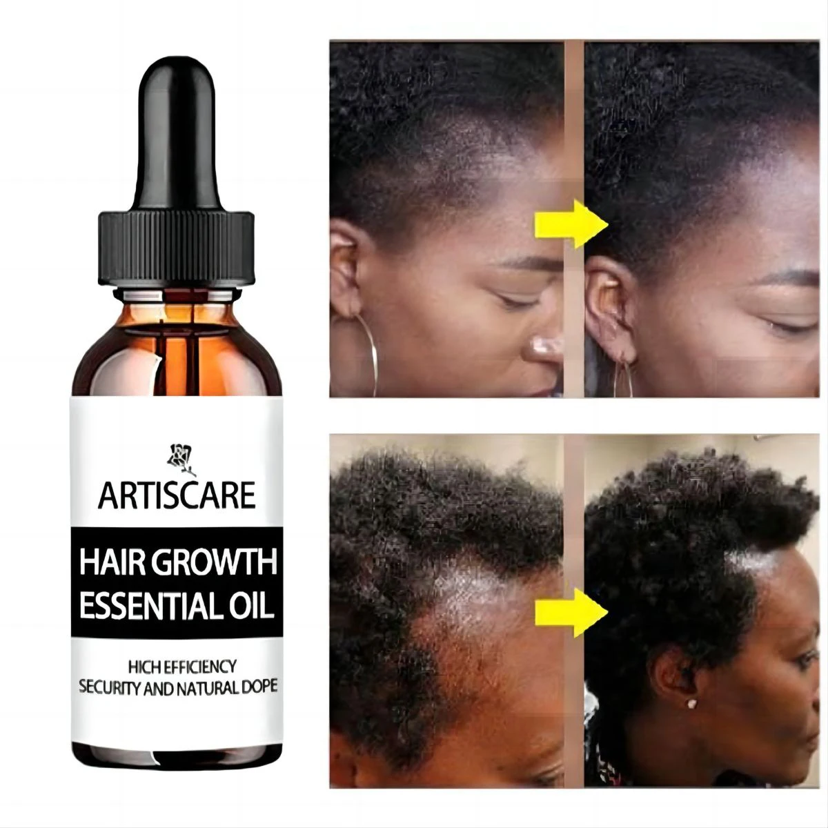 Hair-Growth-Essence-Oil-for-Men-Beard-Growth-Tool-Professional ...