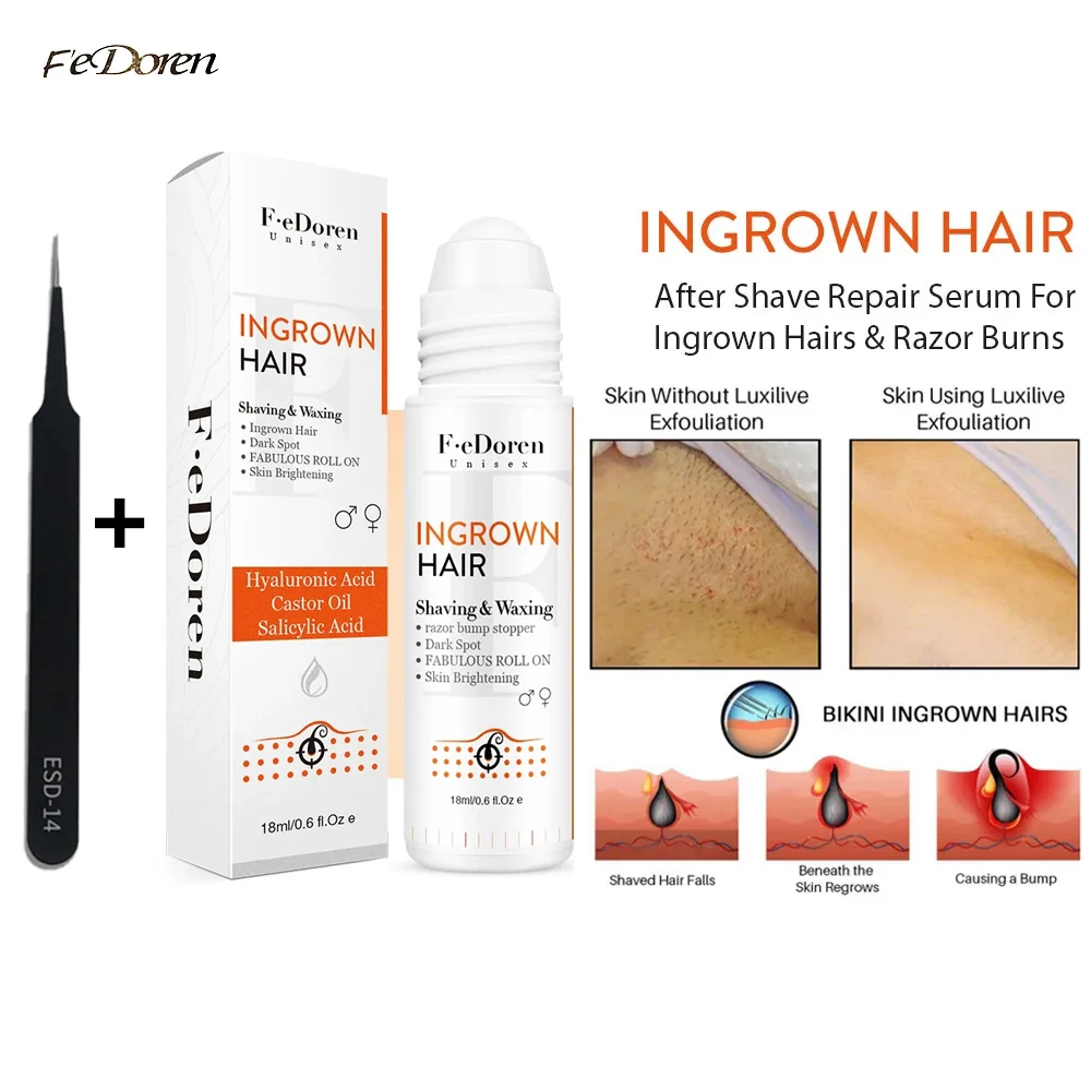 Razor-Bumps-Removal-Solution-Ingrowns-Hair-treatment-Kit-After-Shave ...