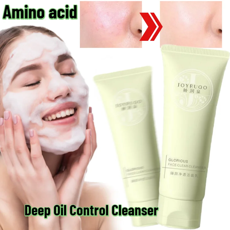 100ML JOYRUQO Amino Acid Soothes Sensitive Skin, Mild and Non-irritating, Deep Cleans Dirt ...