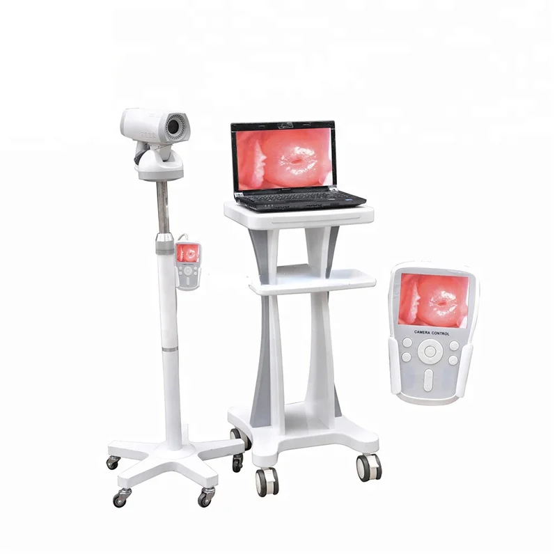Lh9800a Hot Sale Digital Electronic Video Colposcopy For Gynecology ...