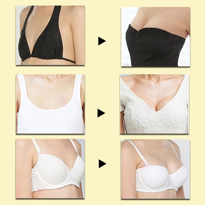 36d Implants Before After