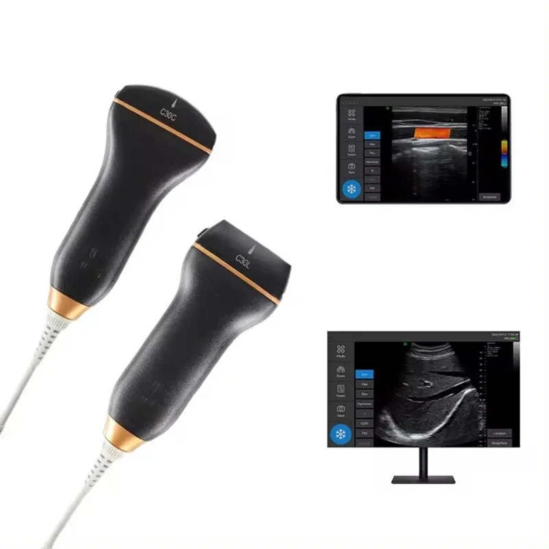 Mini-USB-Type-C-Echo-Color-Doppler-Ultrasound-Scanner-Android-Windows ...