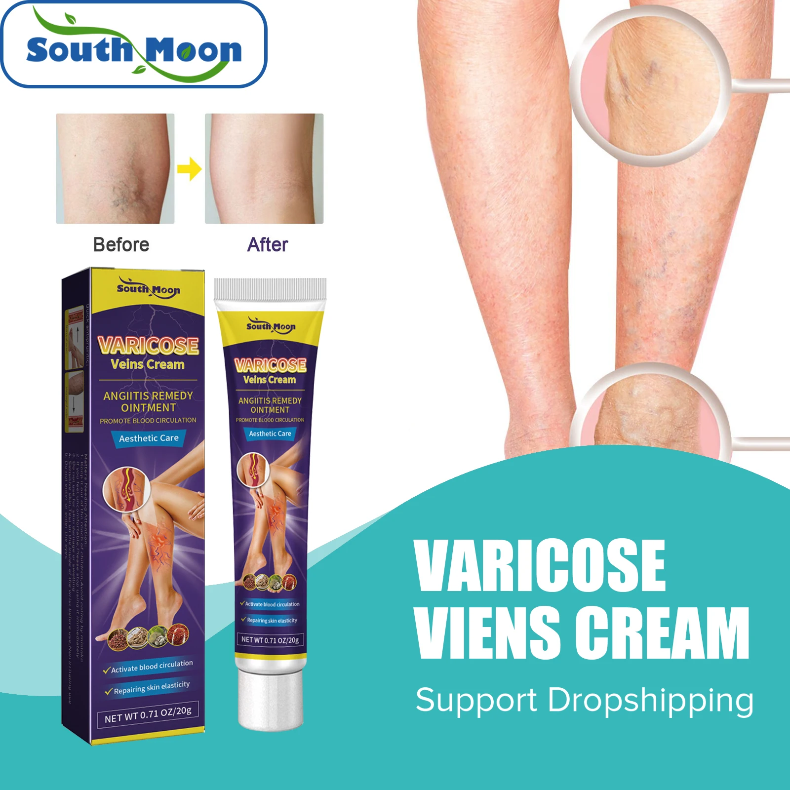 South Moon Veins Treatment Cream Relief Swelling Repair Earthworm Leg ...