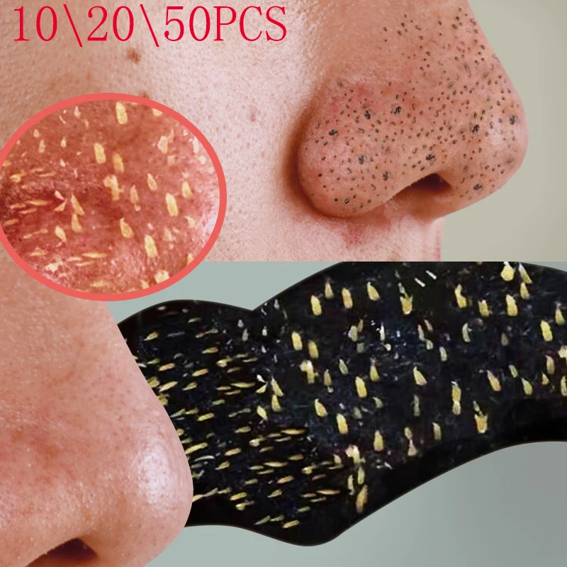 Blackhead Remover Nose Sticker Acne Treatment Mask Nose Sticker 5-60pc ...