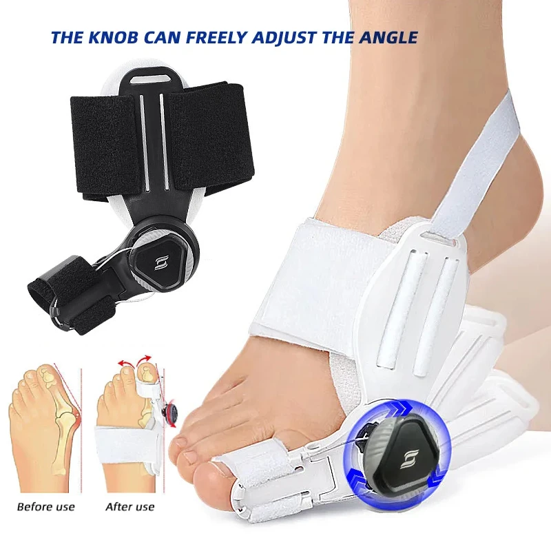 1Pcs 3D Knob Adjustable Hallux Valgus Corrector Orthotic Bunions Finger ...