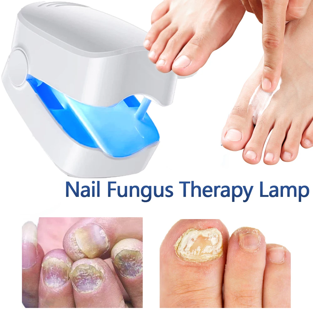 Nail-Fungus-Laser-Treatment-Device-Repair-Toenail-Fingernail-Fungus ...