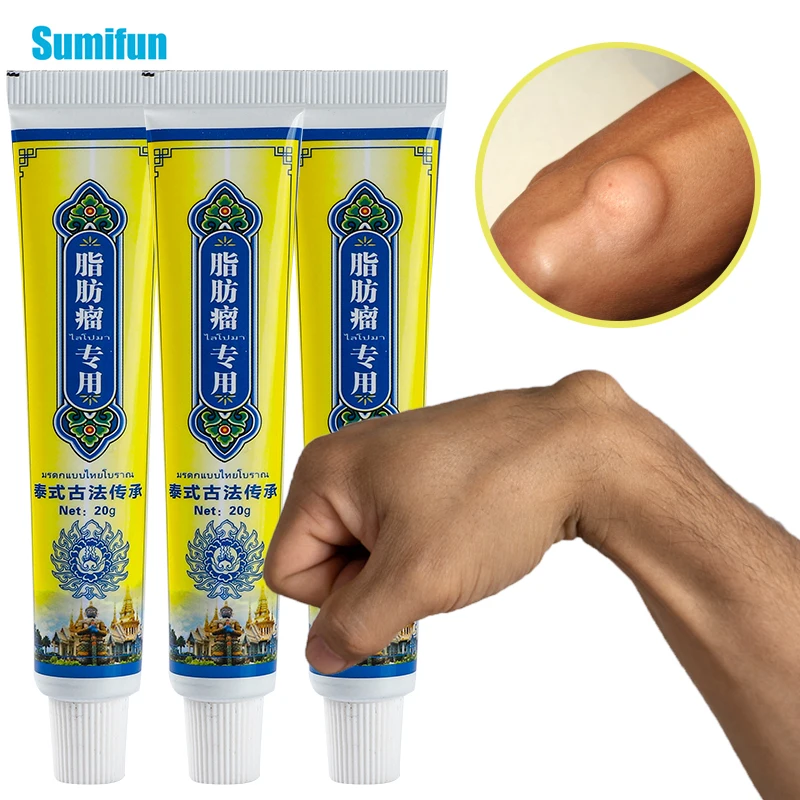 1-3-5Pcs-Lipoma-Removal-Cream-Reduce-Inflammation-Subcutaneous-Lumps ...