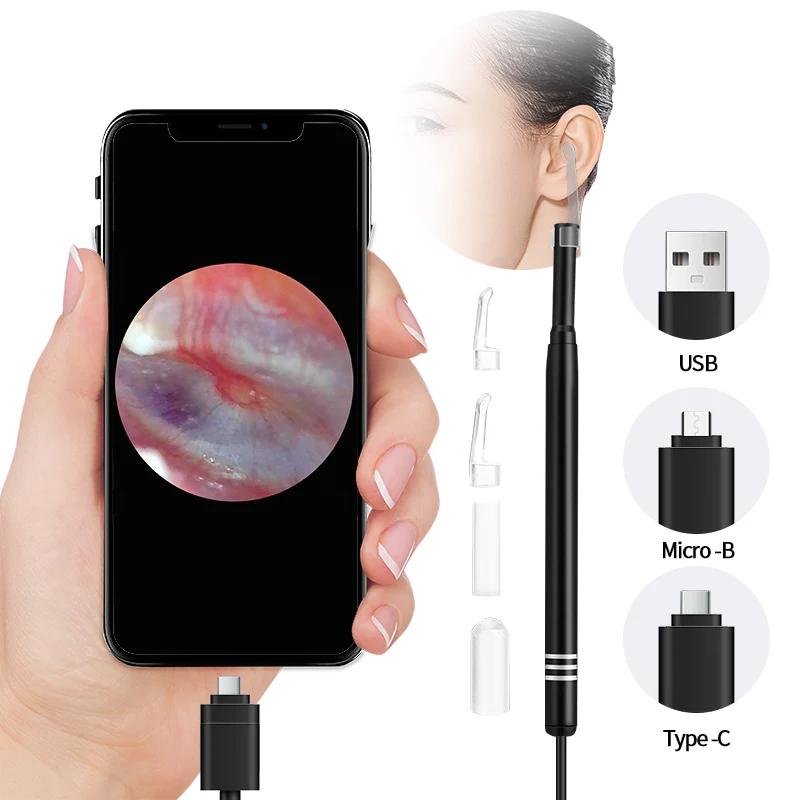 Smart-Visual-Earpick-Endoscope-3-in-1-Ear-Cleaner-Camera-Otoscope-Ear ...