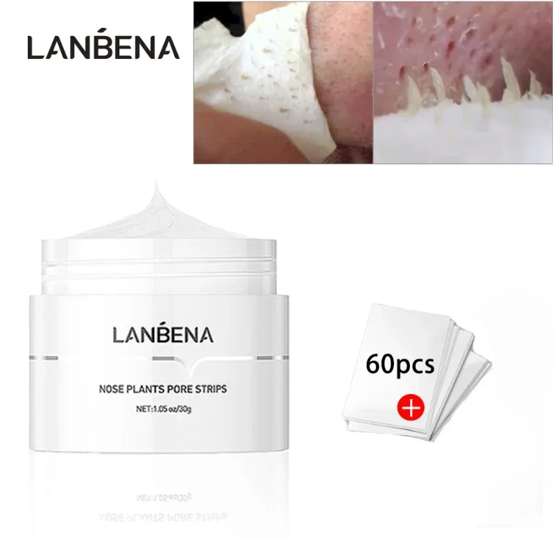 LANBENA-Blackhead-Remover-Nose-Mask-Pore-Strip-Black-Mask-Peeling-Acne ...