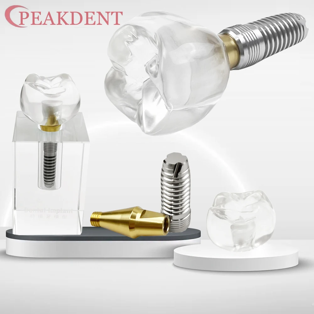 Dental Crystal Implant Model Teeth Communication Transparent Dental ...