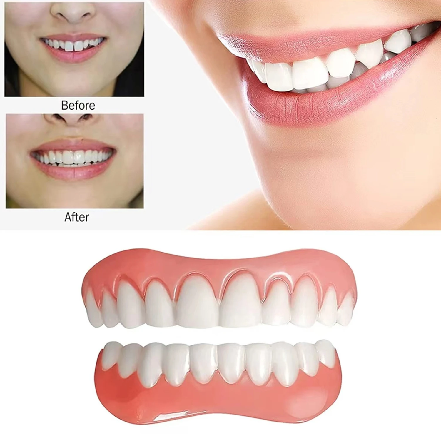 False-Teeth-Silicone-Upper-Lower-Veneers-Perfect-Laugh-Veneers-Dentures ...