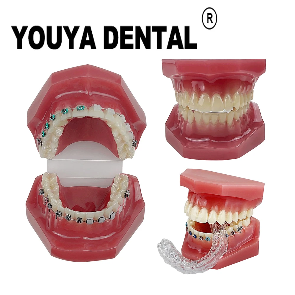 Orthodontic Teaching Model Oral Model Half Ceramic Half Metal Bracket ...