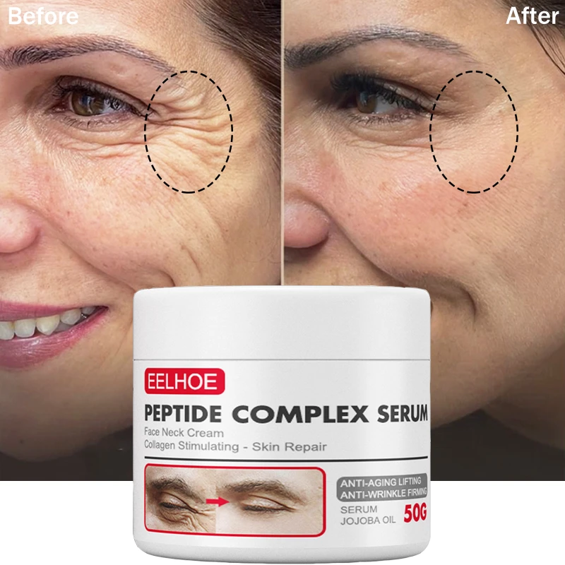 Anti-wrinkle Anti-aging Face Cream Neck Remove Fine Line Lifting ...