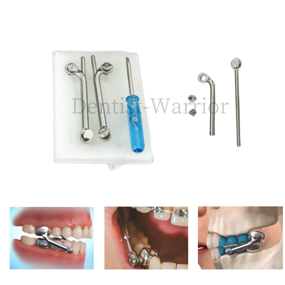 Dental Herbst Appliance Set Dentaurum Socket Screw Telescopic ...