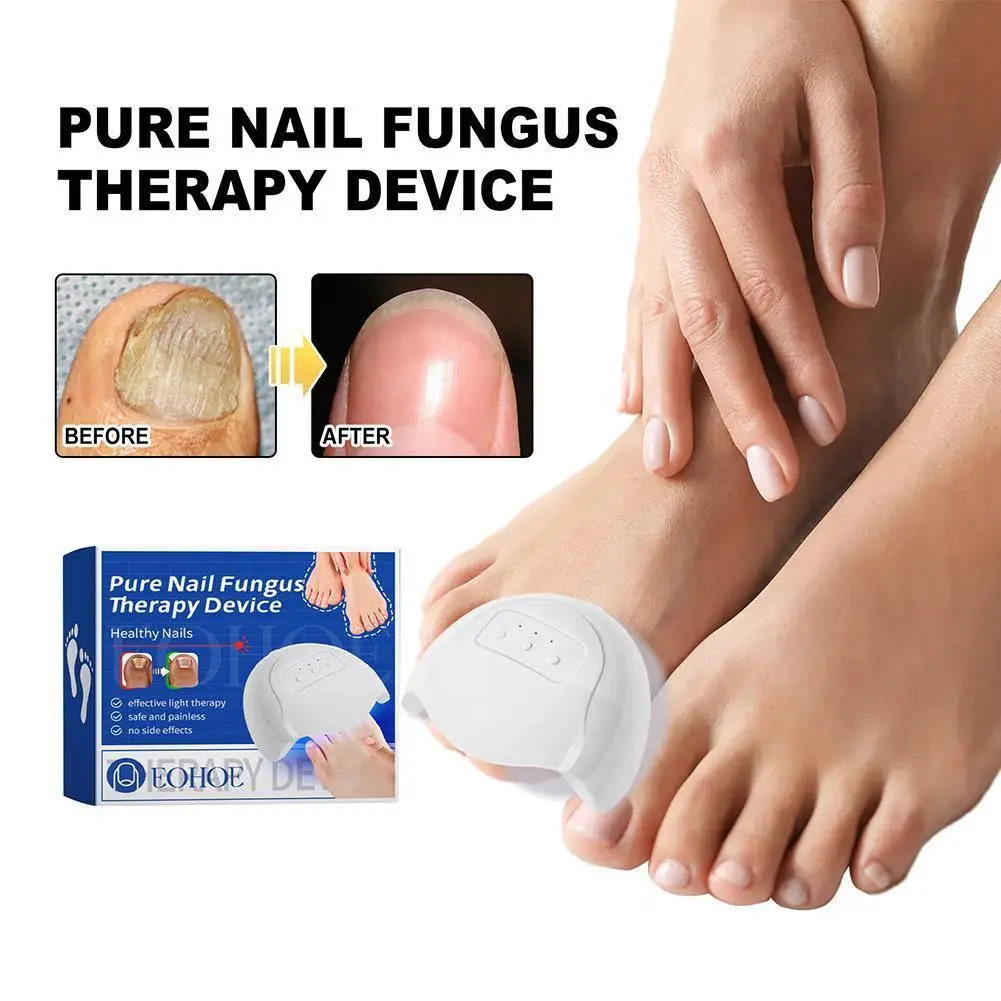 Fungal-Toe-Nail-Device-Repair-Fast-Toenail-Nails-Fungus-Onychomycosis ...