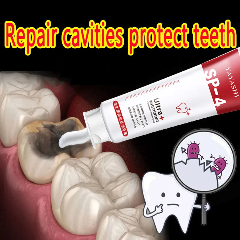 Repair-of-Cavities-Caries-Removal-of-Plaque-Stains-Decay-Whitening ...